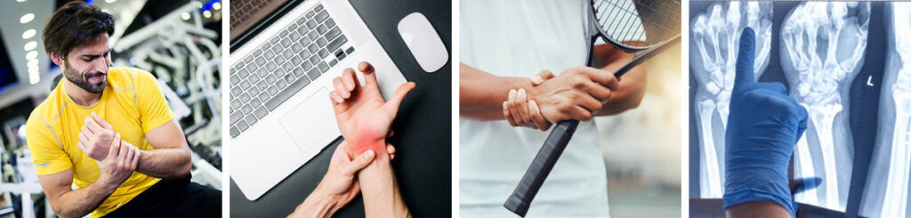 Dr. Schmidtberg - Orthopedic Surgeon Specializing in Hand and Wrist ...
